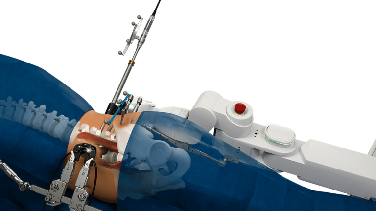 Robotic Surgery | Spine Medicine and Surgery of Long Island