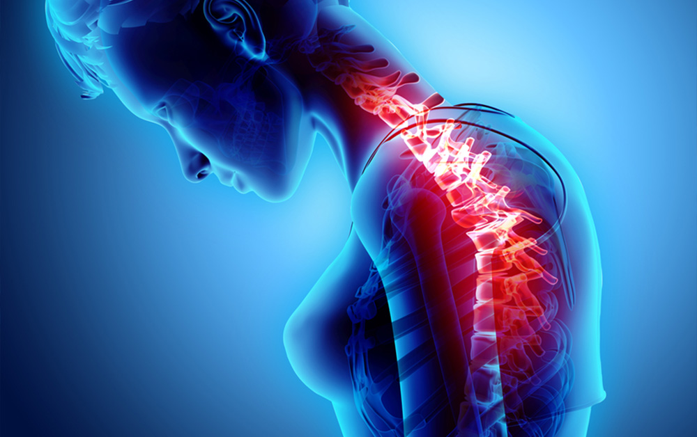 Kyphosis Treatment Ronkonkoma NY | Spine Medicine and Surgery of Long ...